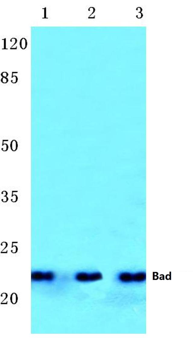 BAD Antibody (PA5-86231)