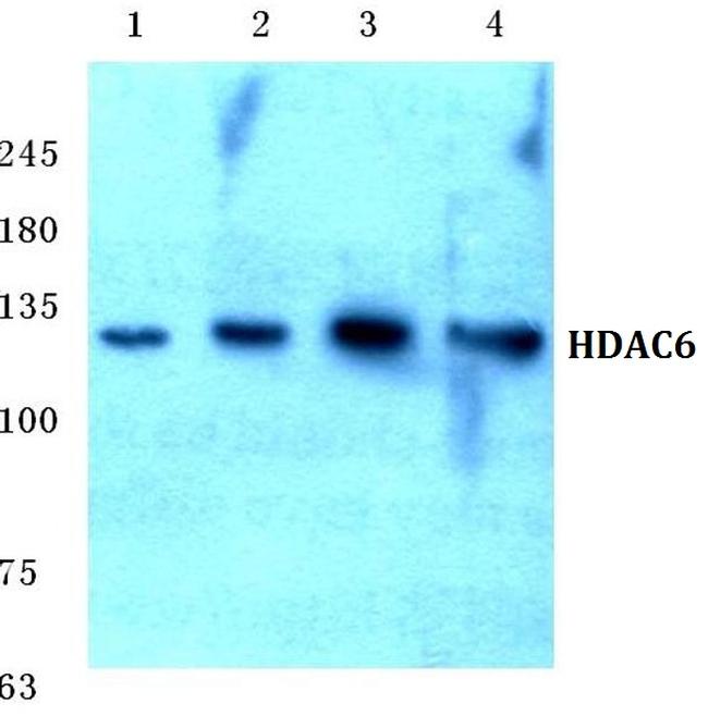 HDAC6 Polyclonal Antibody (PA5-86320)