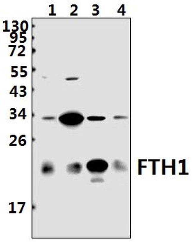 Ferritin Heavy Chain Antibody (PA5-86928)