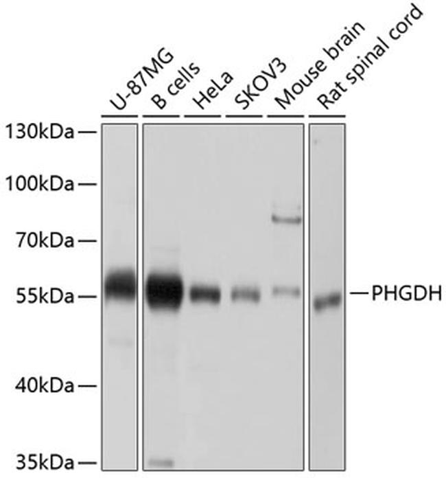 PHGDH Antibody (PA5-87919)