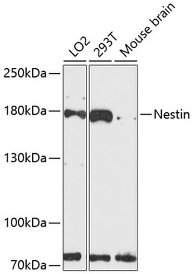 Nestin Antibody (PA5-88268)