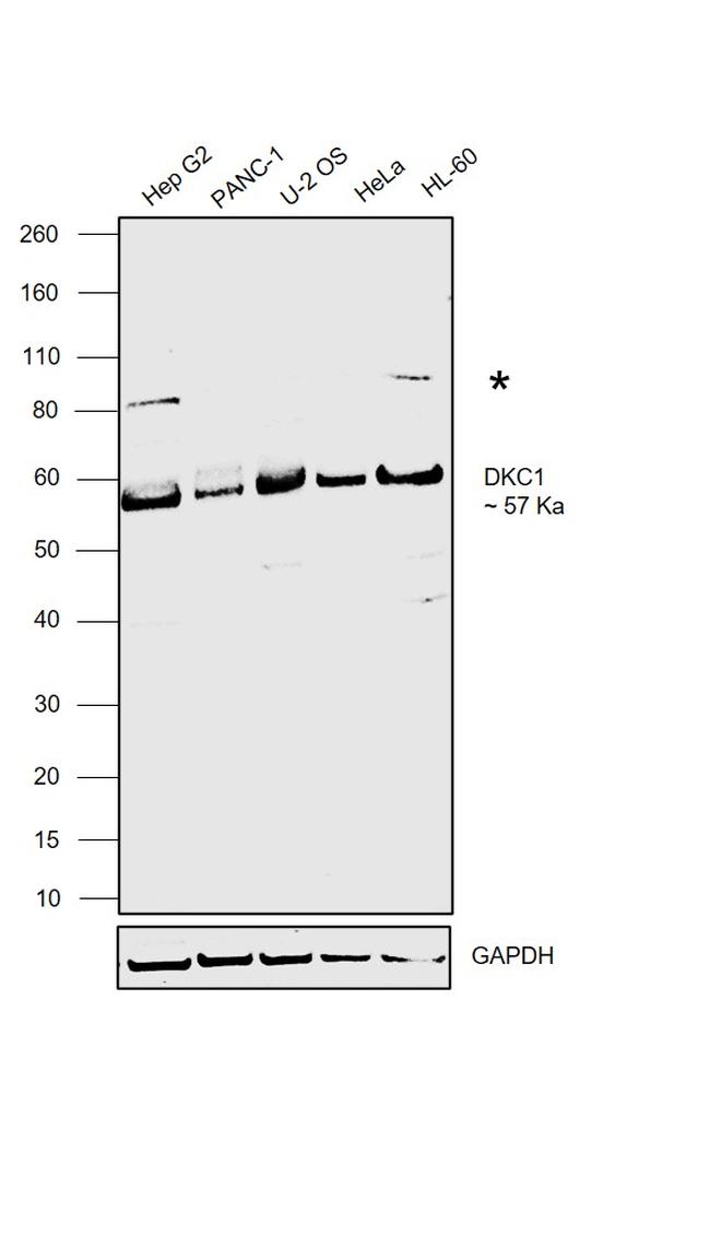 DKC1 Polyclonal Antibody (PA5-88861)