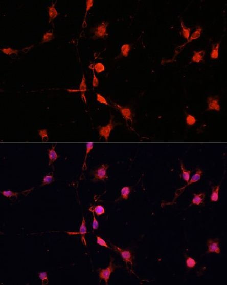 LAMP1 Antibody (PA5-95849)