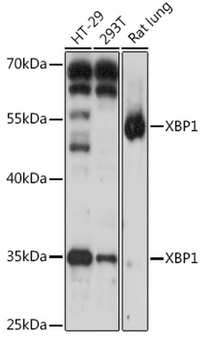 XBP1 Antibody (PA5-95907)
