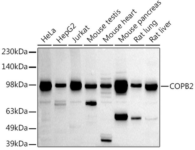 COPB2 Antibody (PA5-96557)