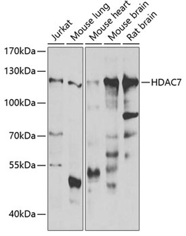 HDAC7 Antibody (PA5-96625)