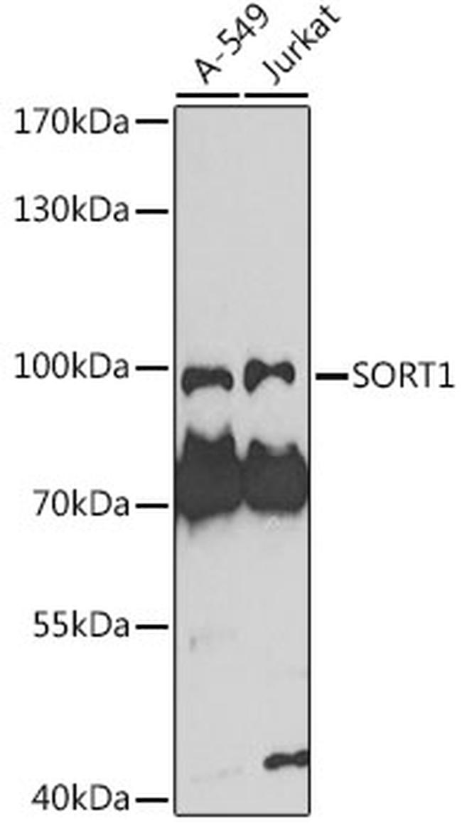Sortilin Antibody (PA5-96865)