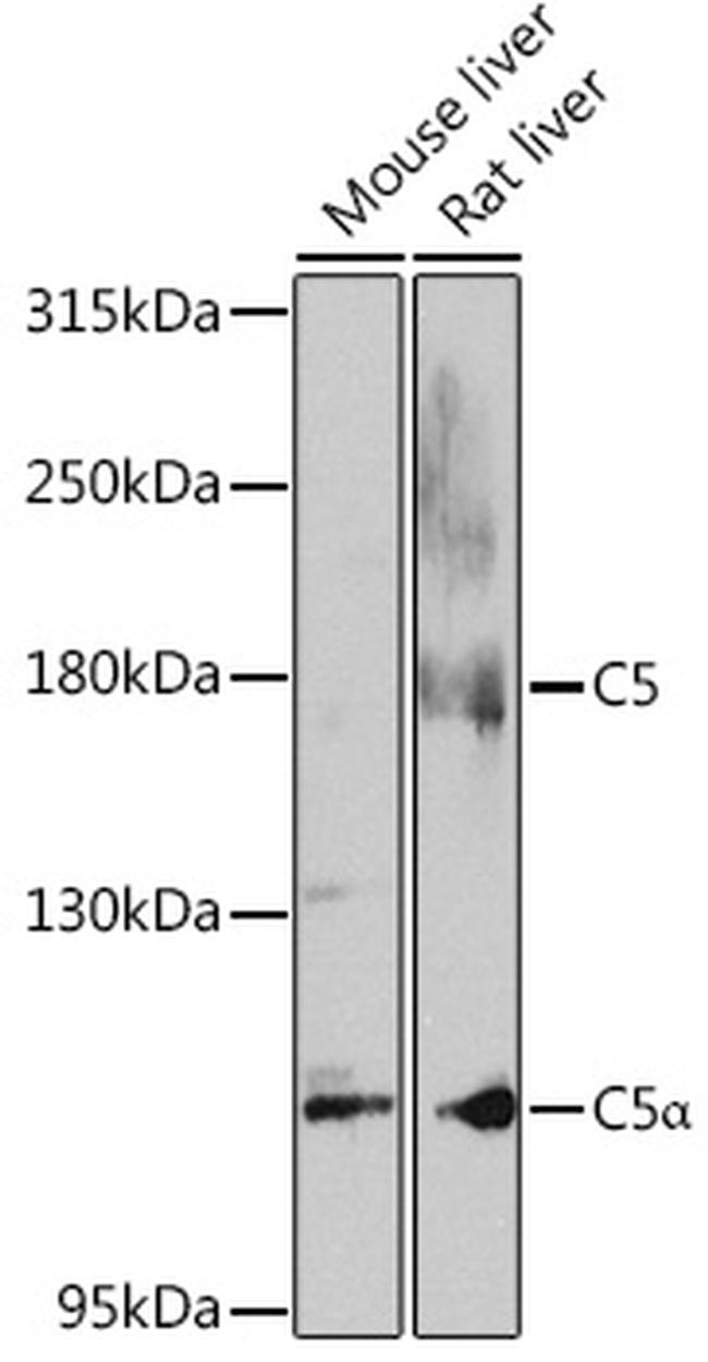 Complement C5 Antibody (PA5-96933)