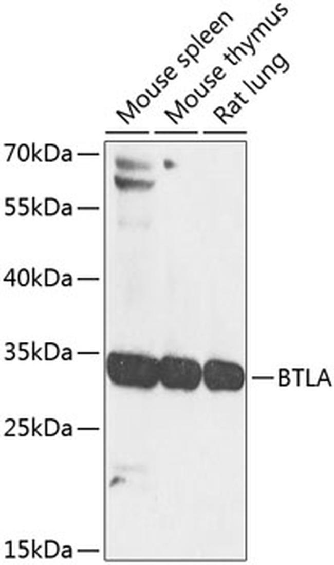 BTLA Antibody (PA5-97029)