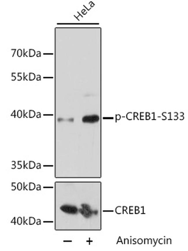 Phospho-CREB (Ser133) Antibody (PA5-97331)