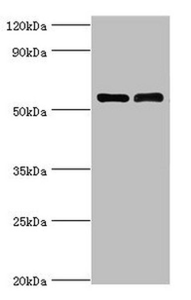CD127 Polyclonal Antibody (PA5-97870)