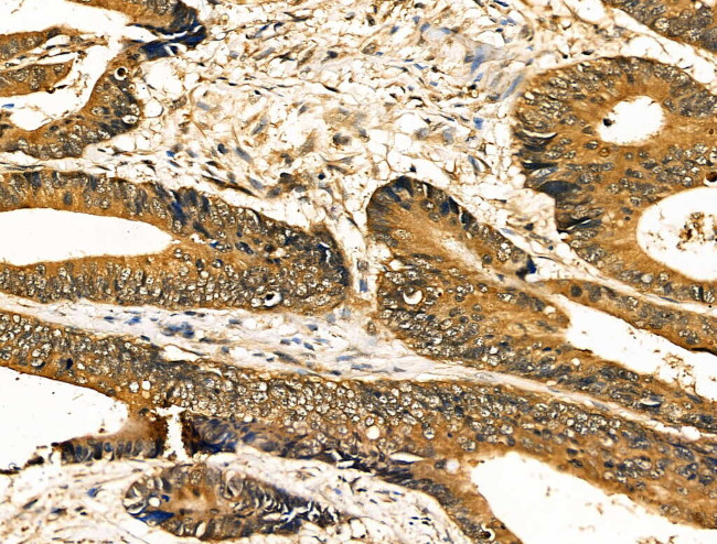 Caspase 8 (Cleaved Asp384) Polyclonal Antibody (PA5-99435)