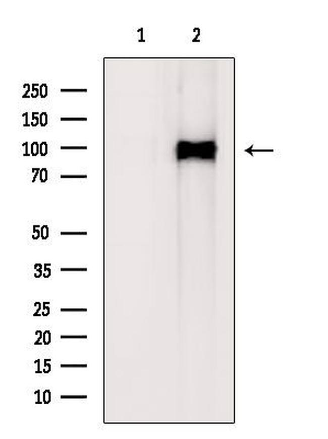 NOTCH1 (Cleaved Val1744) Antibody (PA5-99448)