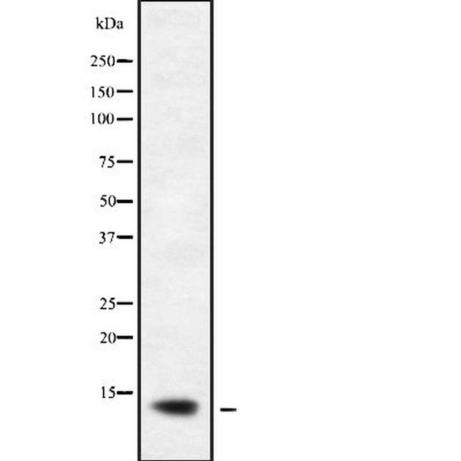XCL1/XCL2 Polyclonal Antibody (PA5-99826)