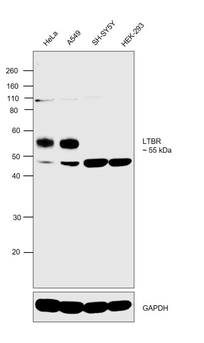 LTBR Polyclonal Antibody (PA5-102743)