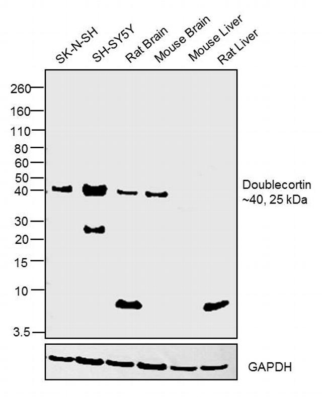 Doublecortin Antibody (PA5-17428)