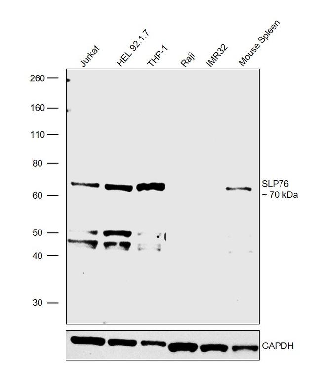 SLP76 Antibody (PA5-17556)