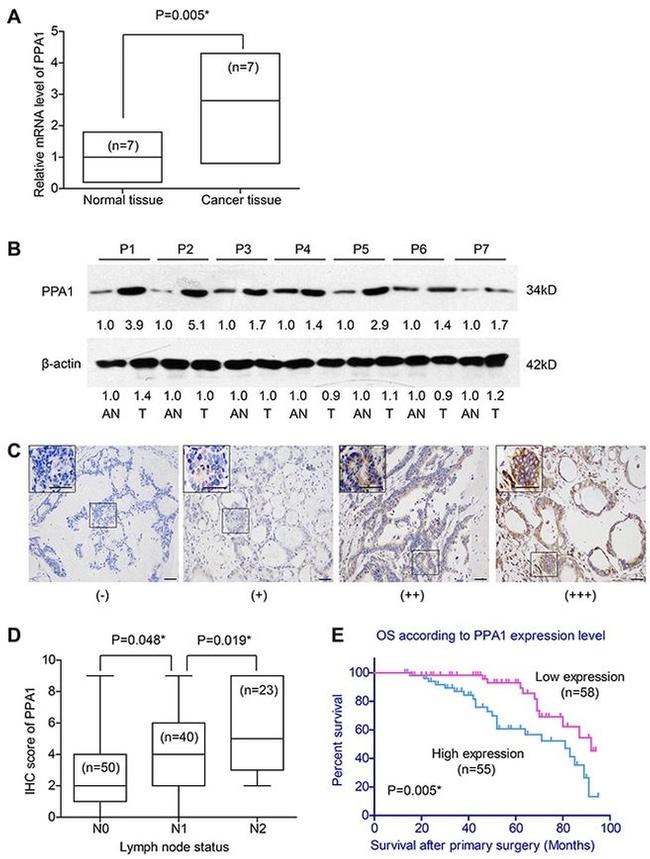 PPA1 Antibody (PA5-22144)