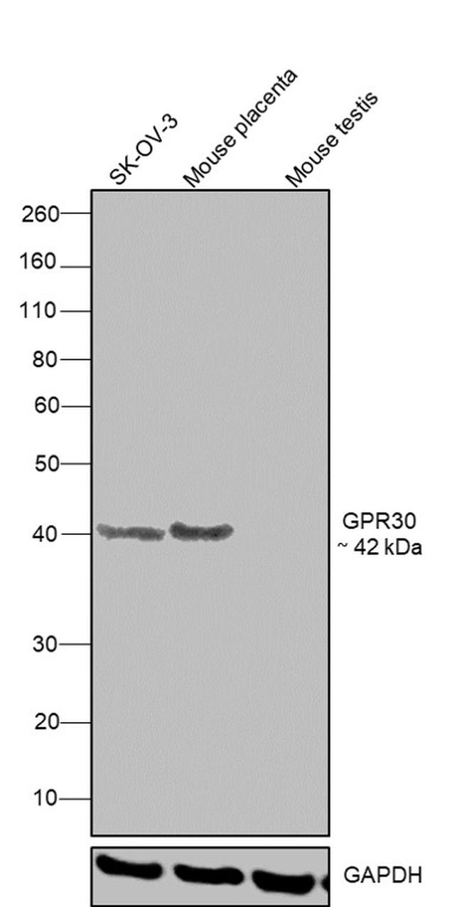 GPR30 Polyclonal Antibody (PA5-28647)