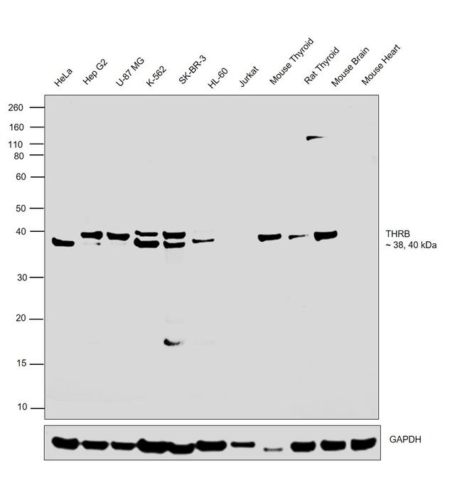 THRB Antibody (PA5-29684)