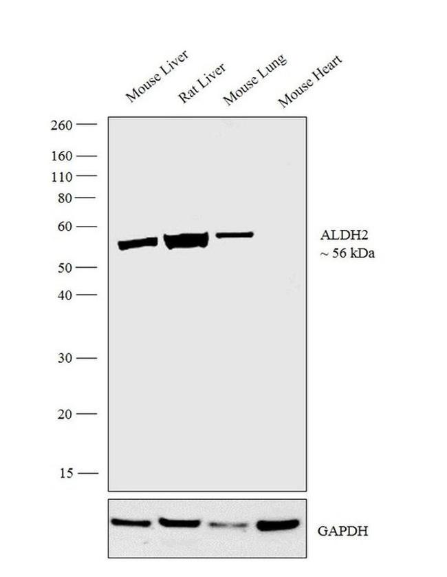 ALDH2 Polyclonal Antibody (PA5-29717)