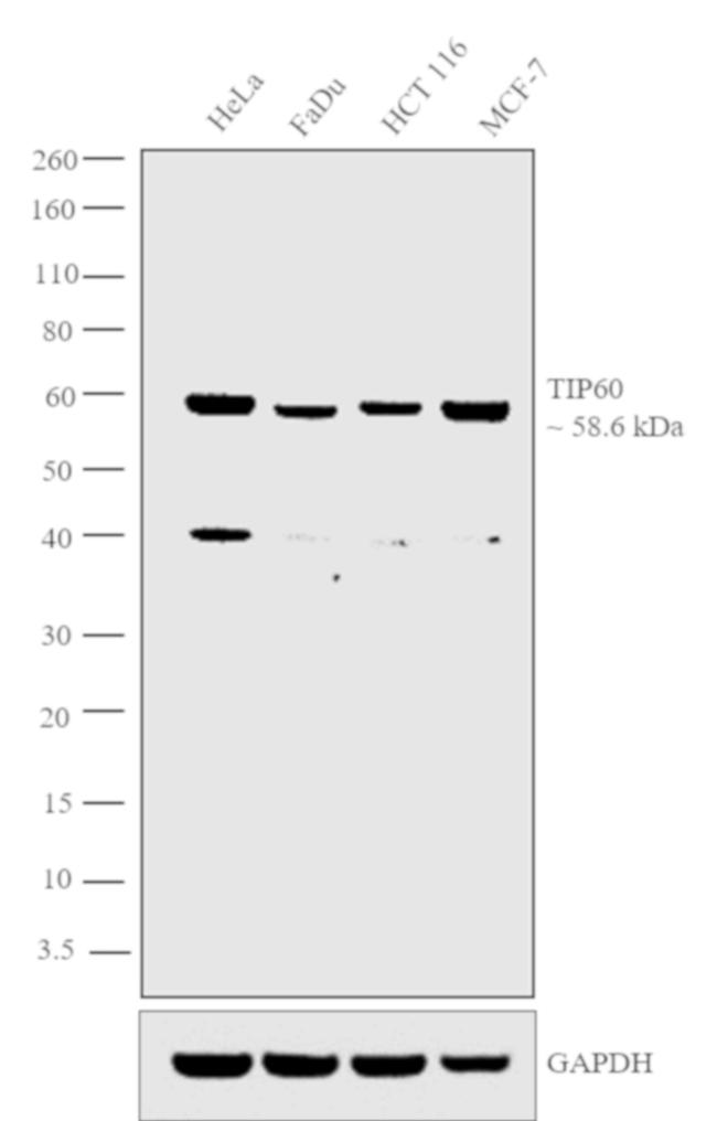 TIP60 Antibody (PA5-34548)