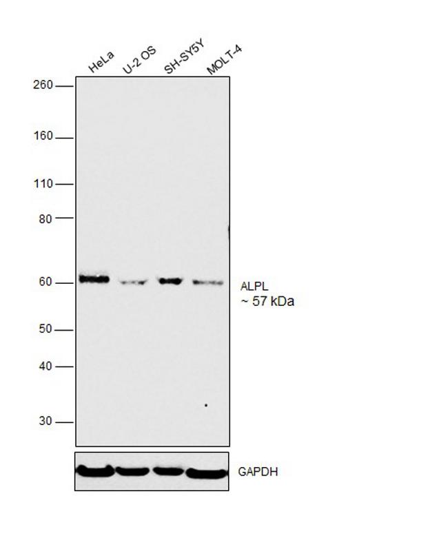 ALPL Antibody (PA5-47419)