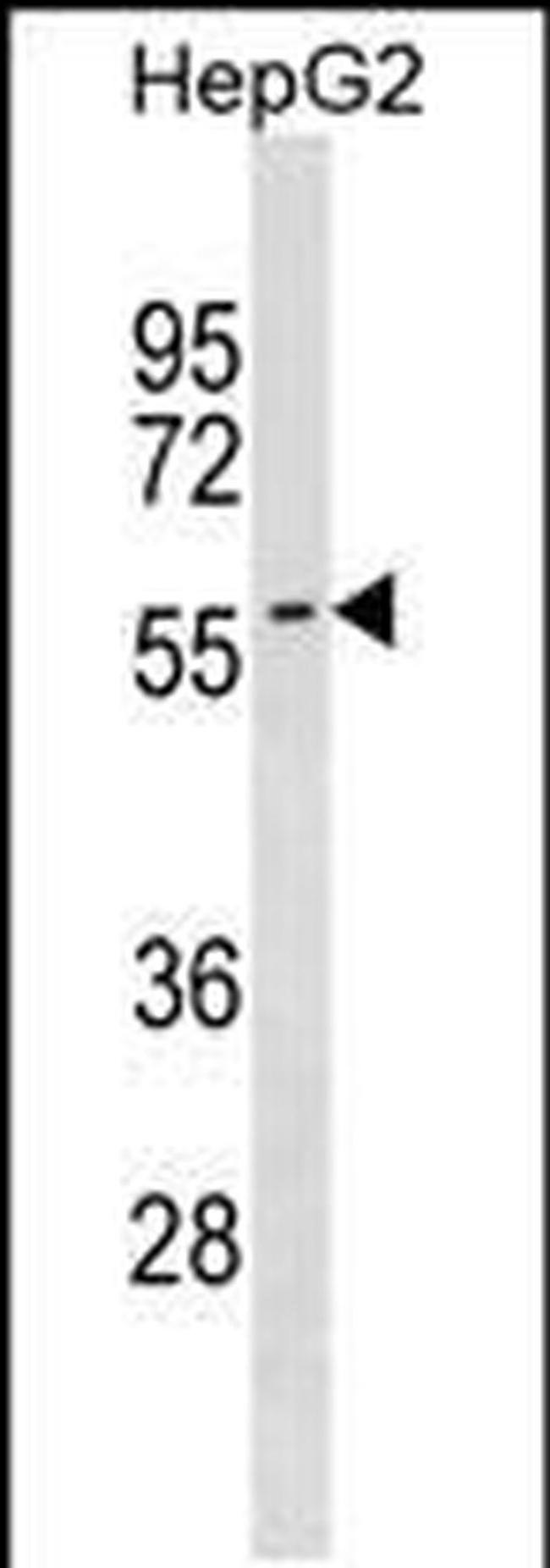 SMPD3 Polyclonal Antibody (PA5-49140)