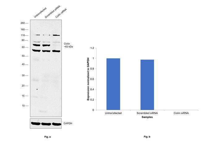 Coilin Antibody (PA5-66995)