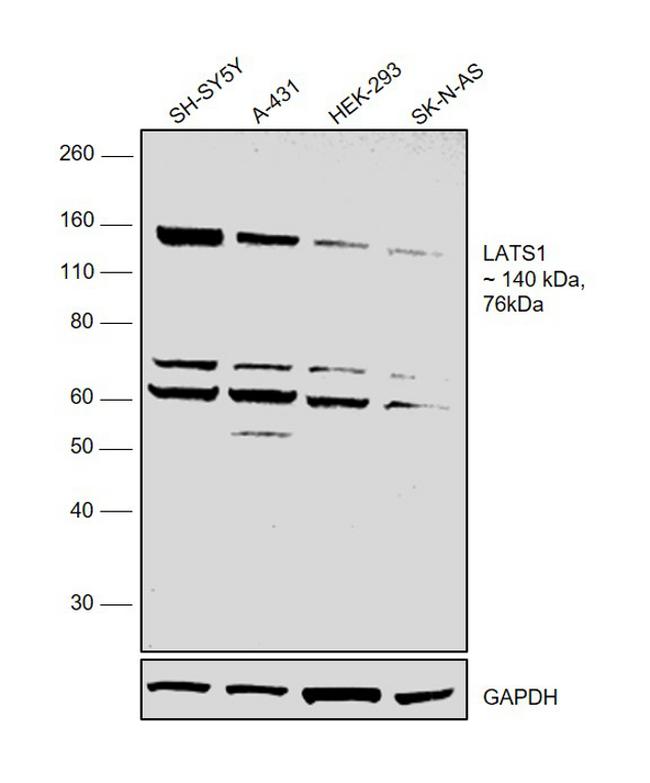 LATS1 Antibody (PA5-78278)