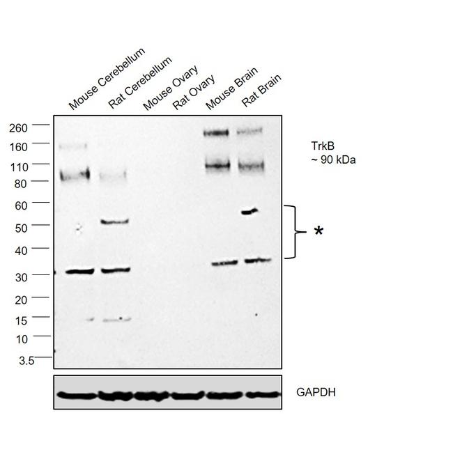 TrkB Polyclonal Antibody (PA5-78405)