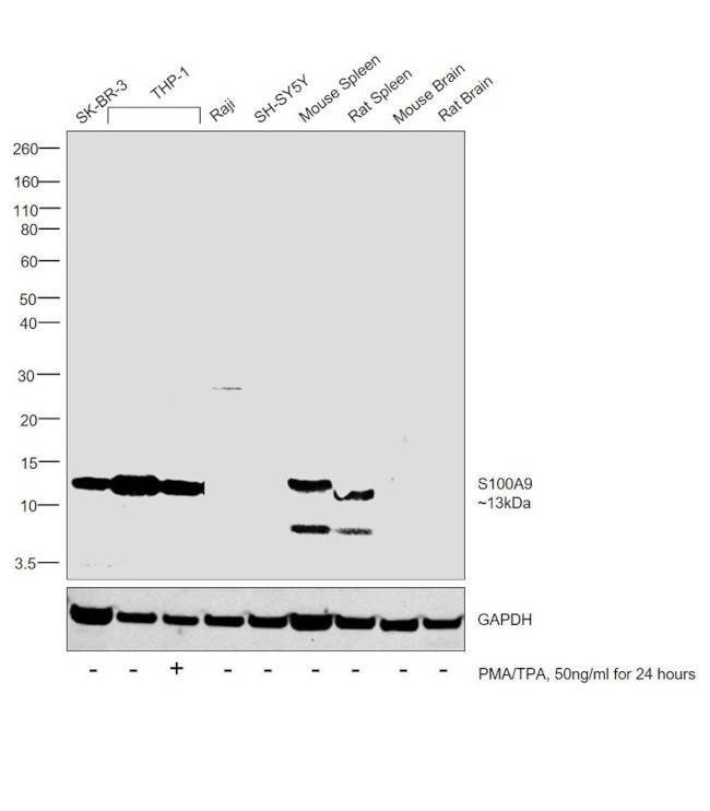 S100A9 Antibody (PA5-79949)