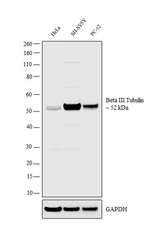 Beta III Tubulin Antibody (PA5-85884)