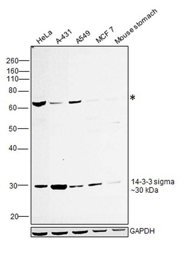 14-3-3 sigma Polyclonal Antibody (PA5-95056)
