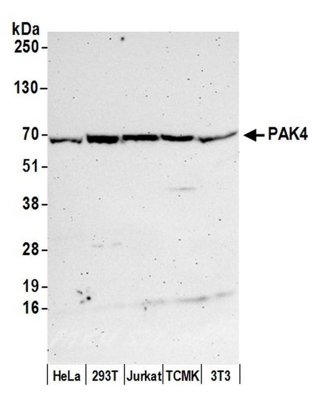 PAK4 Polyclonal Antibody (A300-356A)