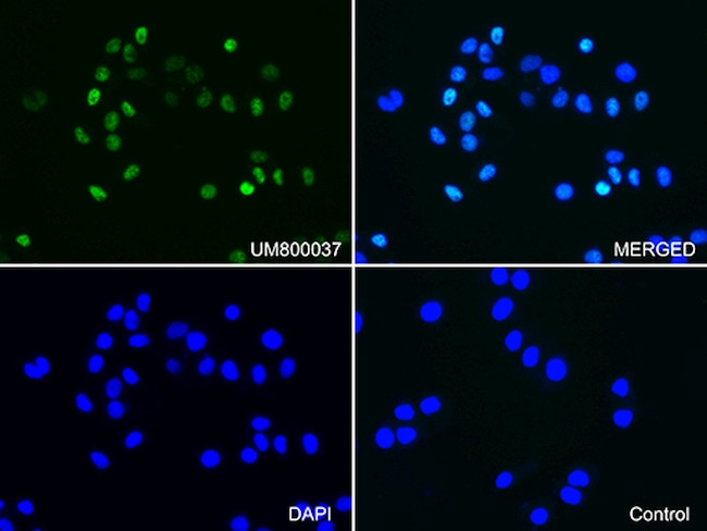 PGR Antibody (UM800037CF)