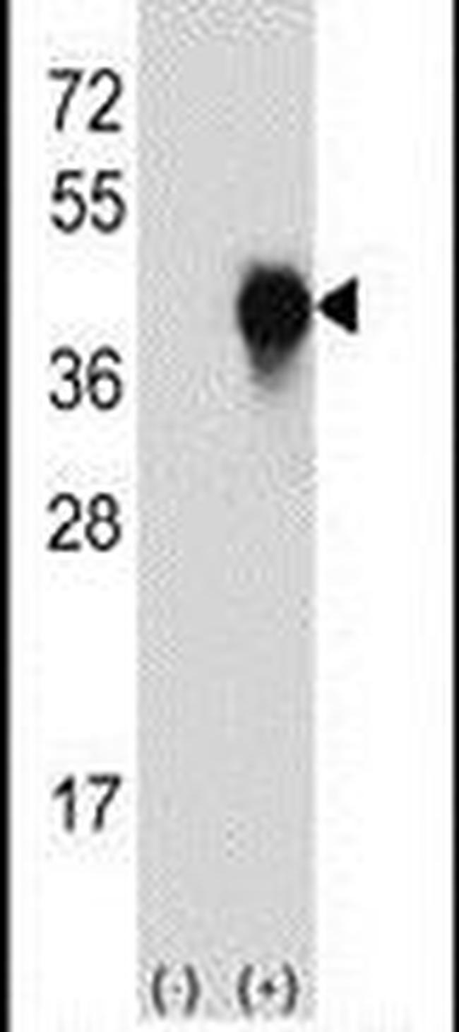 uPAR Antibody (PA5-15478)