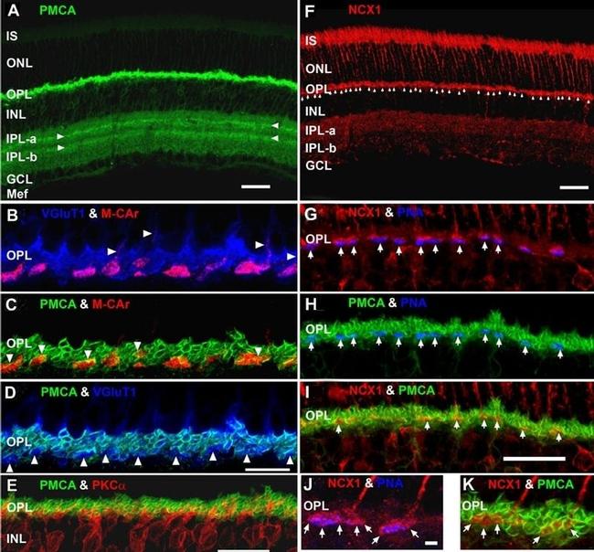 PMCA ATPase Antibody (MA3-914)