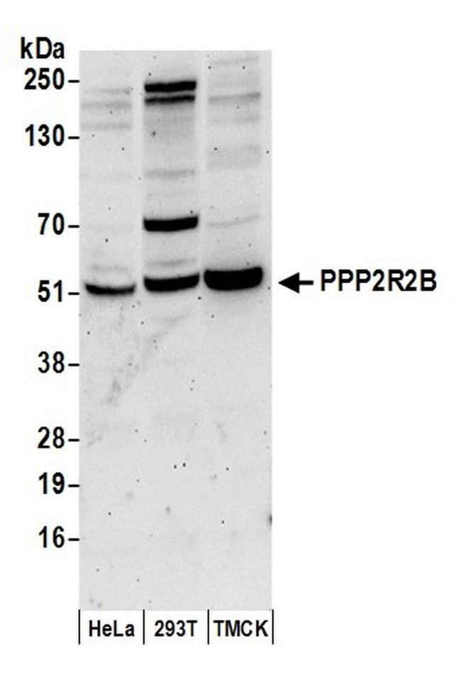 PPP2R2B Antibody (A300-964A)