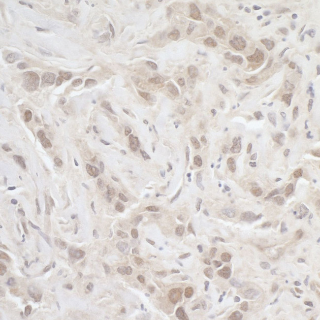 PPP3CA Antibody (A300-908A)