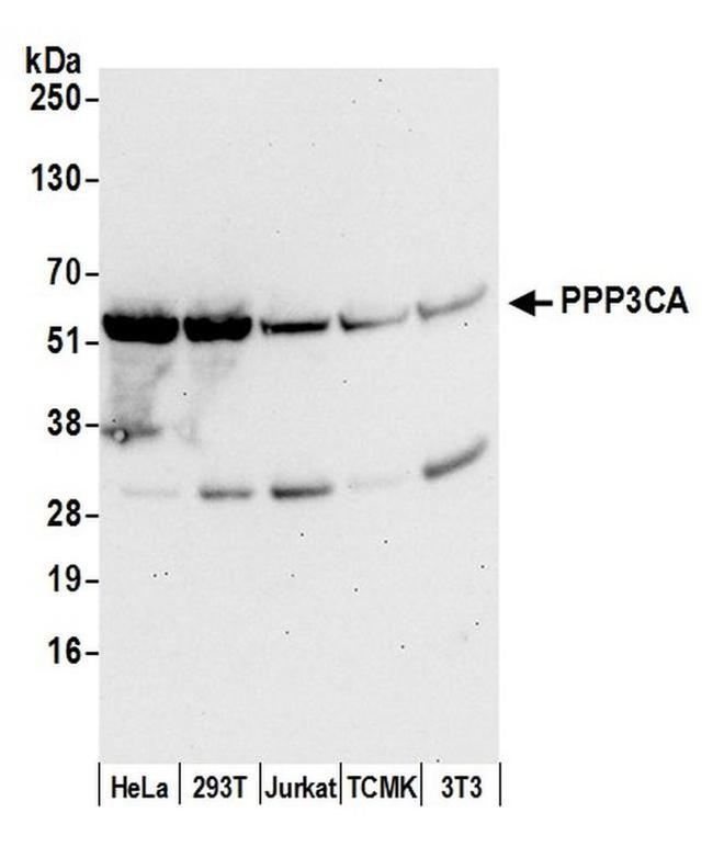 PPP3CA Polyclonal Antibody (A300-908A)