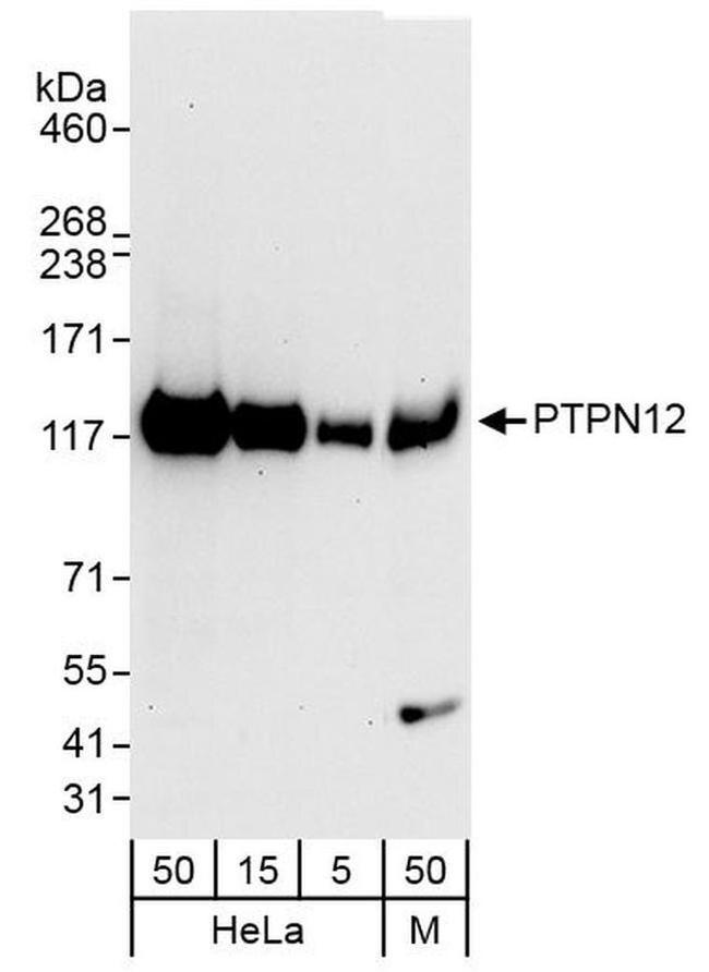 PTPN12 Polyclonal Antibody (A301-302A-T)