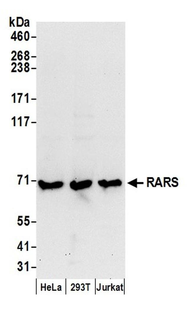 RARS Polyclonal Antibody (A304-749A-T)