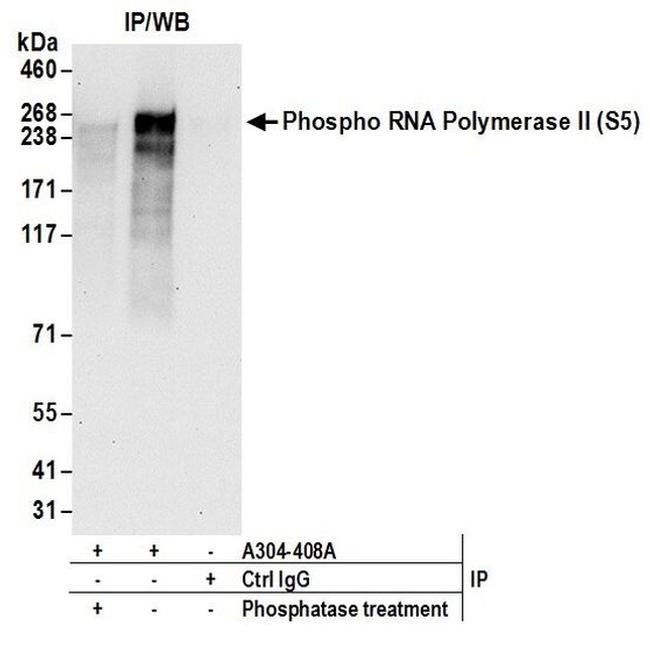Phospho-RNA Polymerase II (Ser5) Antibody (A304-408A)