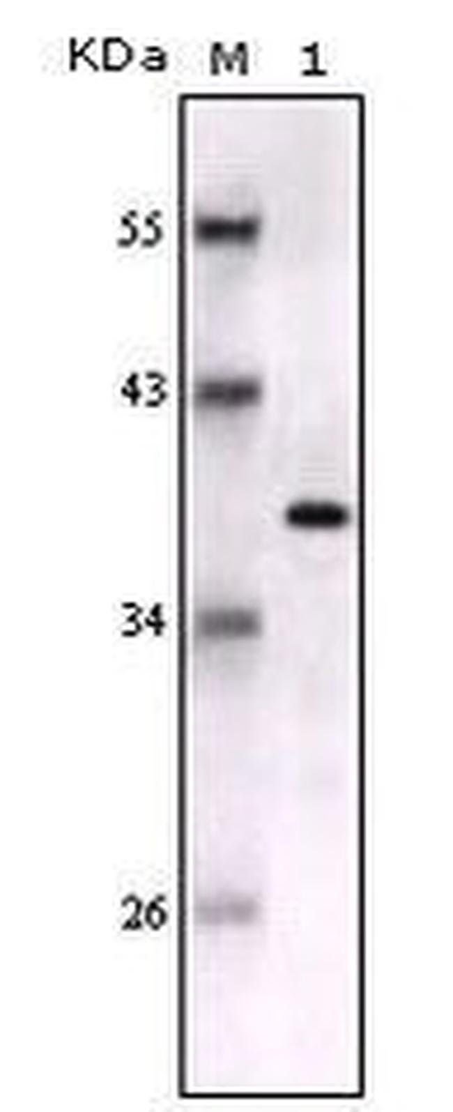 S100B Antibody (MA5-15359)