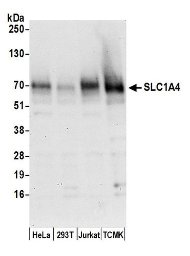SLC1A4/ASCT1 Polyclonal Antibody (A305-283A)