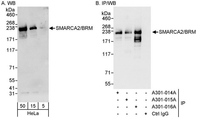 SMARCA2/BRM Polyclonal Antibody (A301-016A)