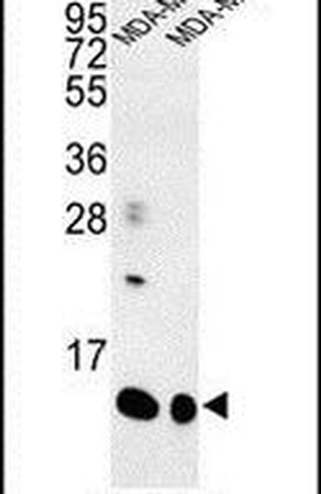 SPRR1B Polyclonal Antibody (PA5-26062)