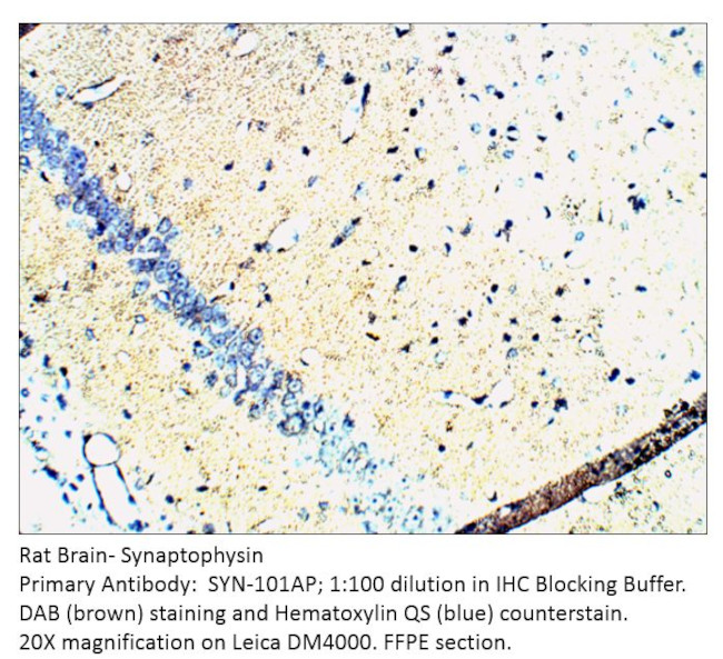 Synaptophysin Polyclonal Antibody (SYN-101AP)
