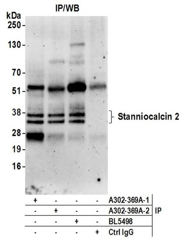 Stanniocalcin 2 Antibody (A302-369A)